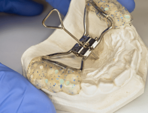 Interproximal Reduction (IPR) - High Line Orthodontics